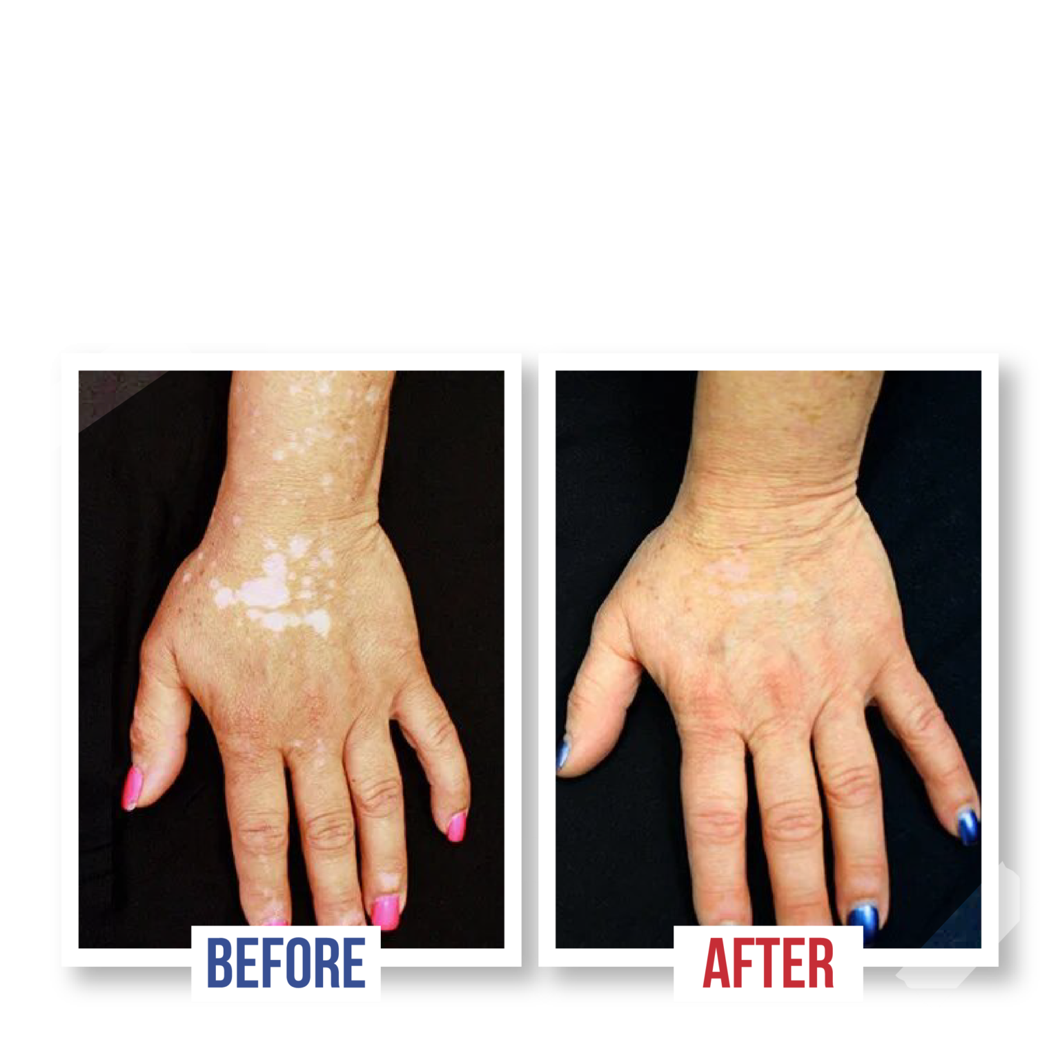 Medlight 630 Pro – Infrared LED Pain Relief Device