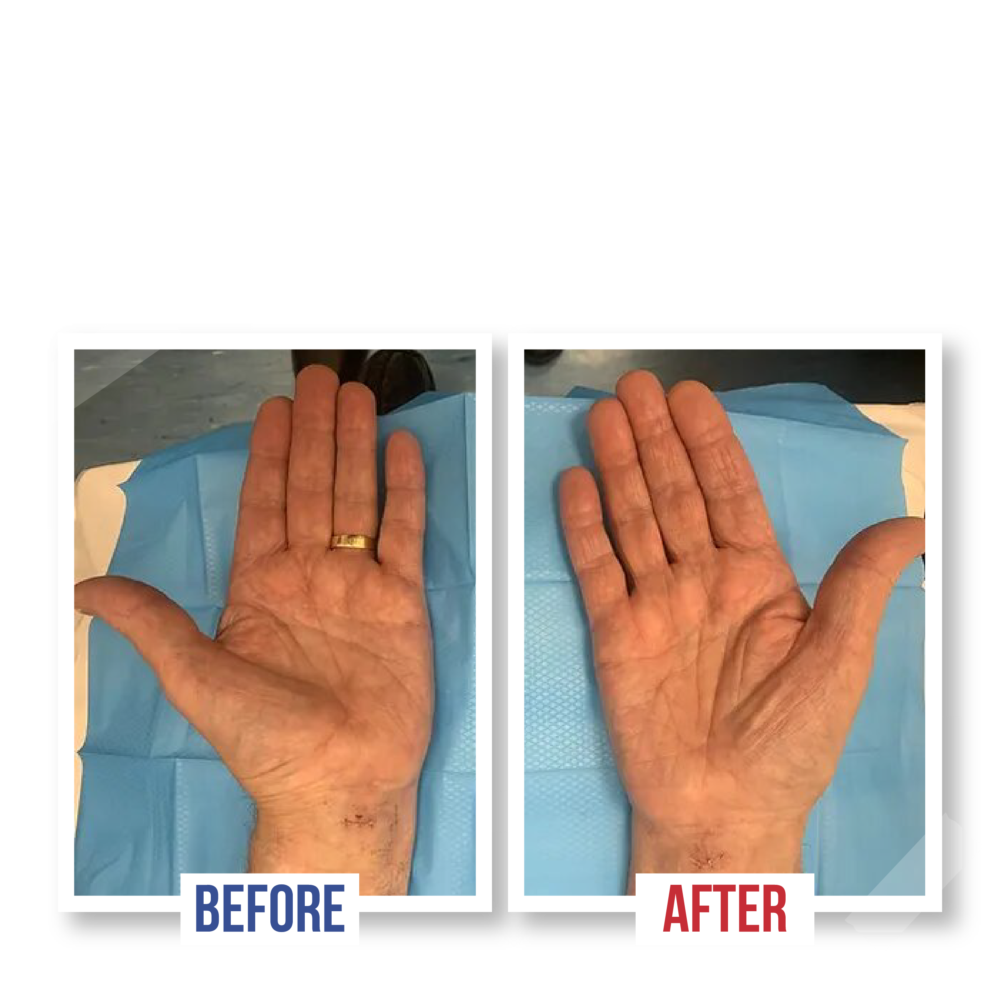 Medlight 630 Pro – Infrared LED Pain Relief Device