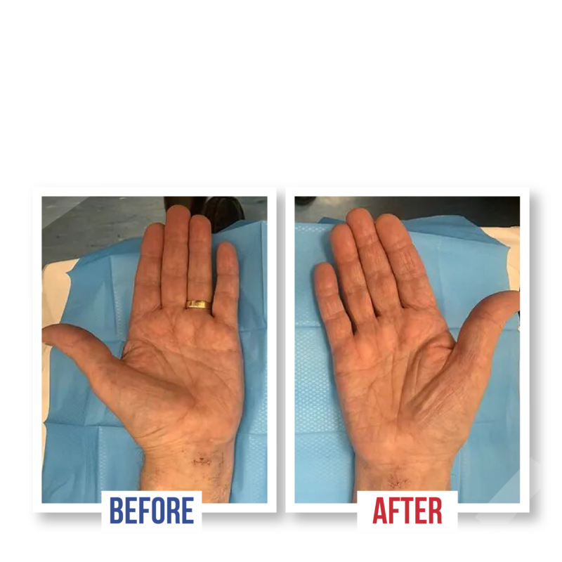 Medlight 630 Pro – Infrared LED Pain Relief Device